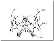Medicine Decoded: Lines of Dolan and the elephants of Rogers